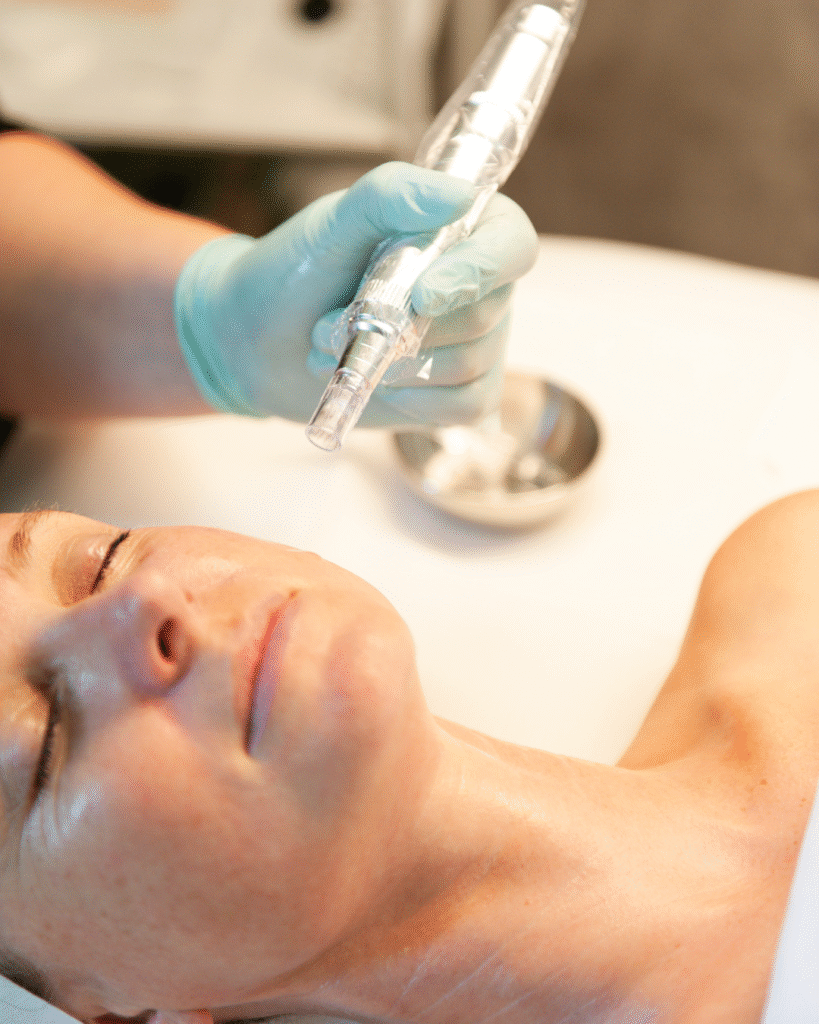 Facial Rejuvenation and Microneedling | Heidi Kao and associates
